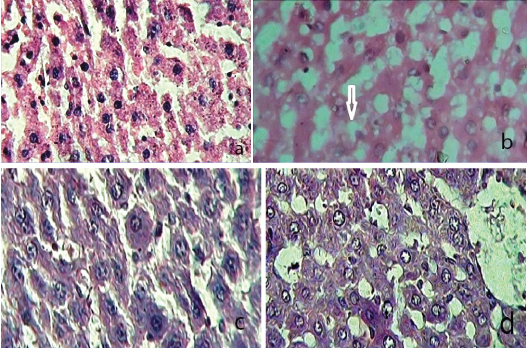 *Arrow indicates fat deposits