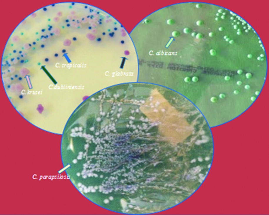 Candida species with different colored creamy colonies appear on CHROM ...