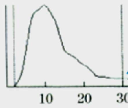 Platelet histogram of case 10 showing a significant number of cells ...