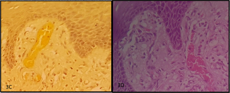 c) tissue section stained with TEM, d) tissue section stained with H&E ...