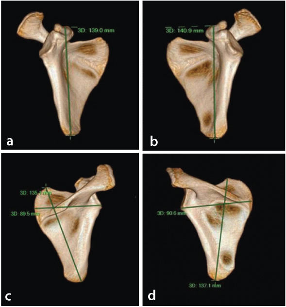 Right Vs Left Scapula