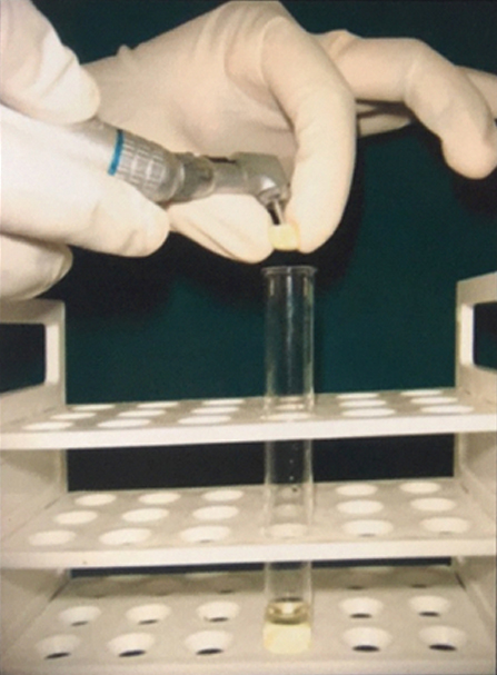 Determination of the Minimum Inhibitory Concentration (MIC) Using ...