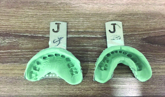 Shows maxillary and mandibular casts.