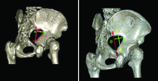 Greater Sciatic Notch Function