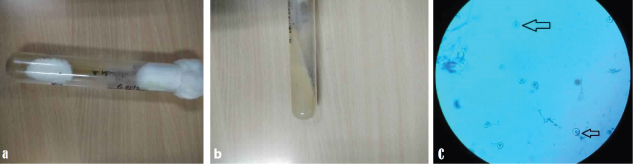 (a) Growth on SDA (Obverse): White velvety growth. (b) Growth on SDA ...