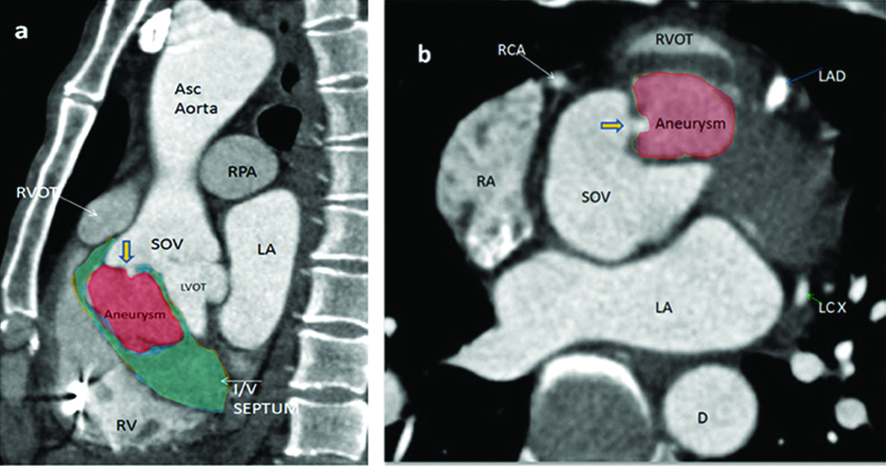 [Table/Fig-1c]: