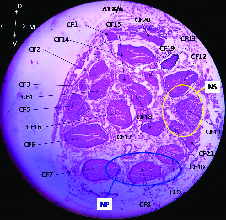 Nerve Cross Section Slide Labeled