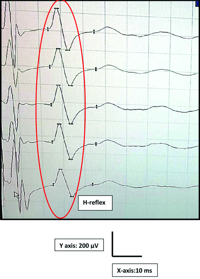Statistical Analysis