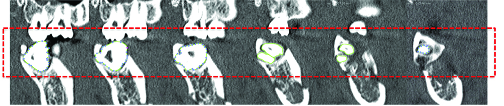 Resultant 3D model of M3.