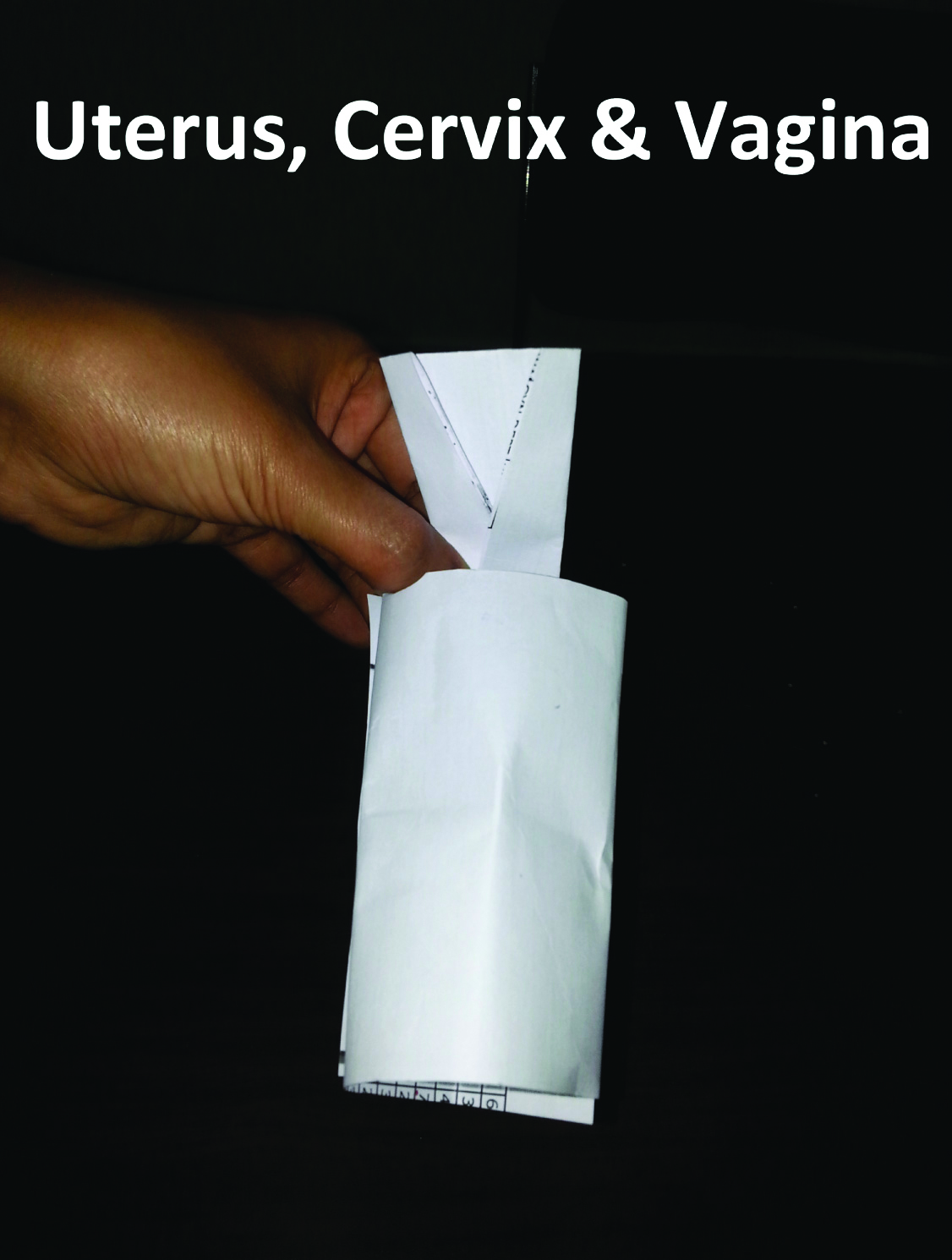 Uterus, cervix, adnexa and peritoneum.