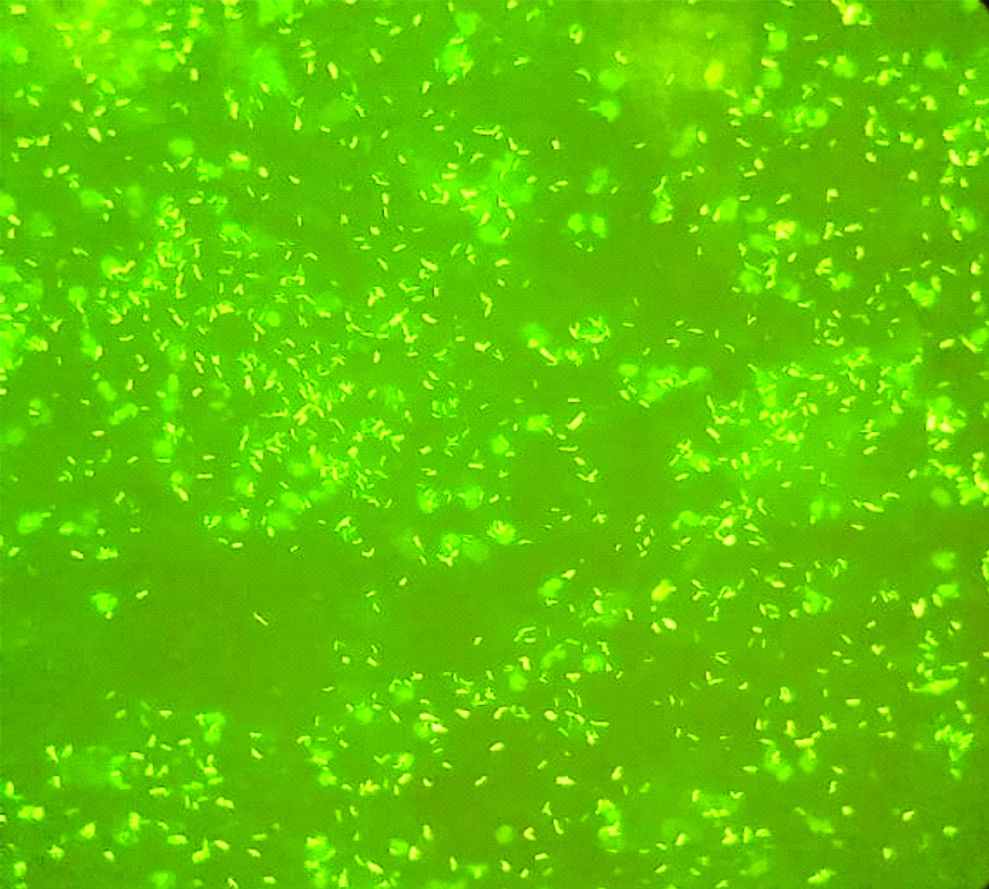 Sputum smear showing tuberculous bacilli stained using Auramine stain ...