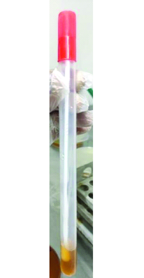 Estimation of Microbial Counts