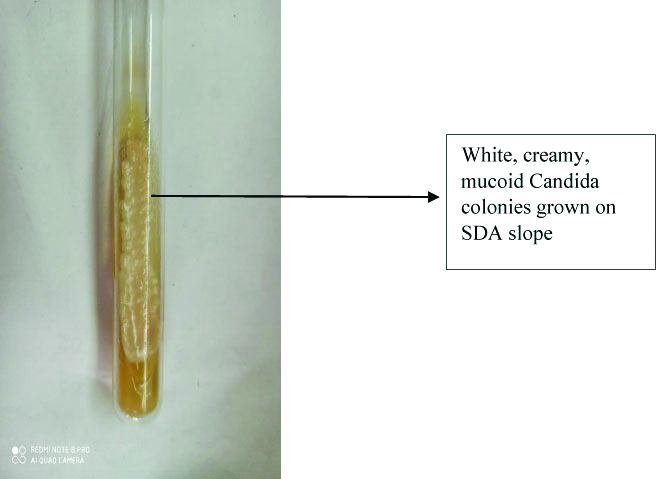 Gram stain of Candida albicans showing typical oval budding yeast cells ...