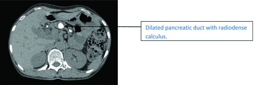 [Table/Fig-2]: