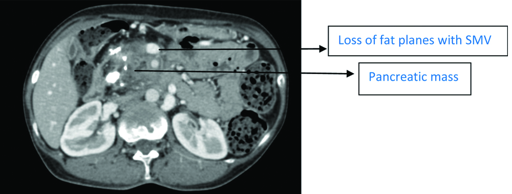 [Table/Fig-4]: