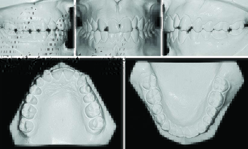 Pretreatment examinations: a) panoramic; b) periapical; c) lateral ...