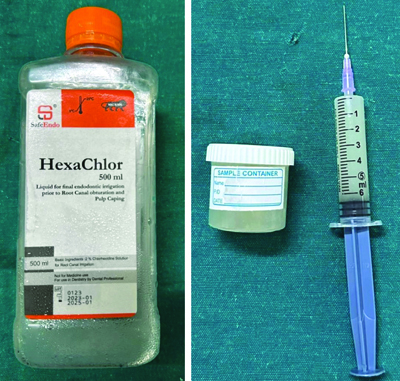 Two pretreatment materials.