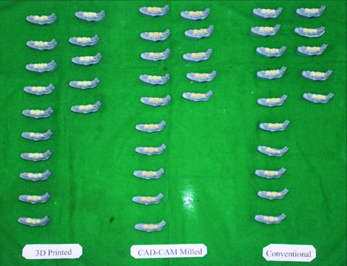 Cemented interim prosthesis on master model -3D printed FPD, CAD/CAM ...