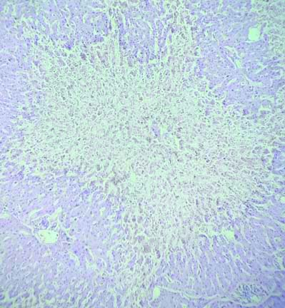 The histopathological picture of the liver shows hepatocytes with fatty ...