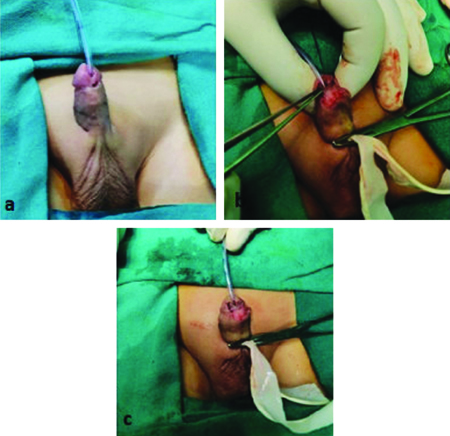 Techniques of repair.