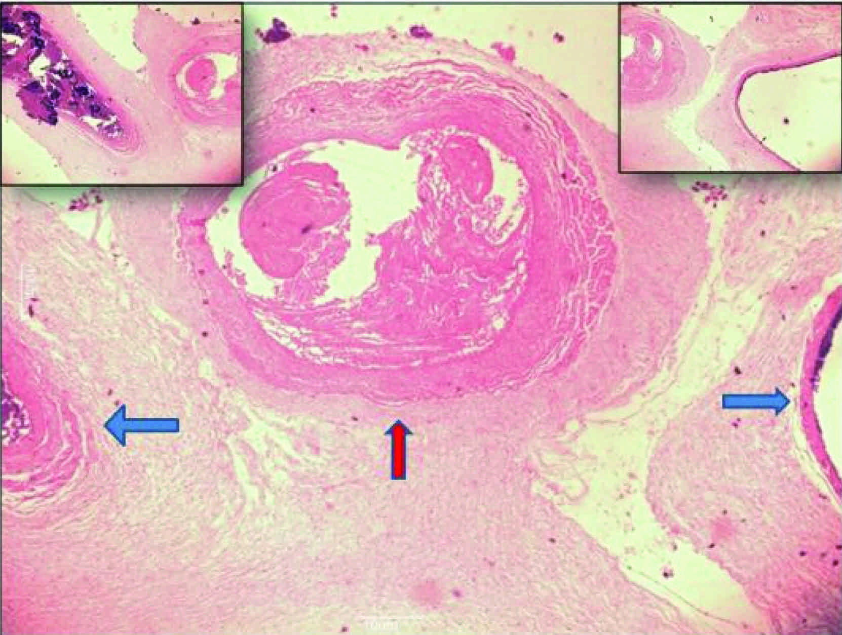 Haematoxylin and eosin stained section (10x magnification) of umbilical ...