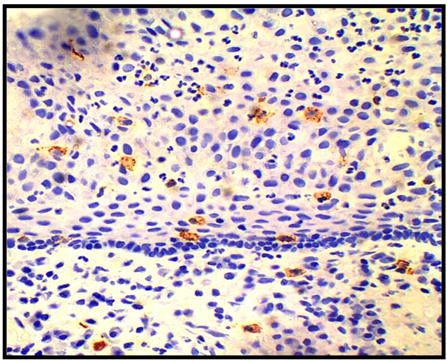 Distribution of mast cells in Periapical Cyst Group (40X)