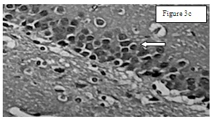 Group 4: Short Arrow indicates apoptotic cells and long arrow (black ...