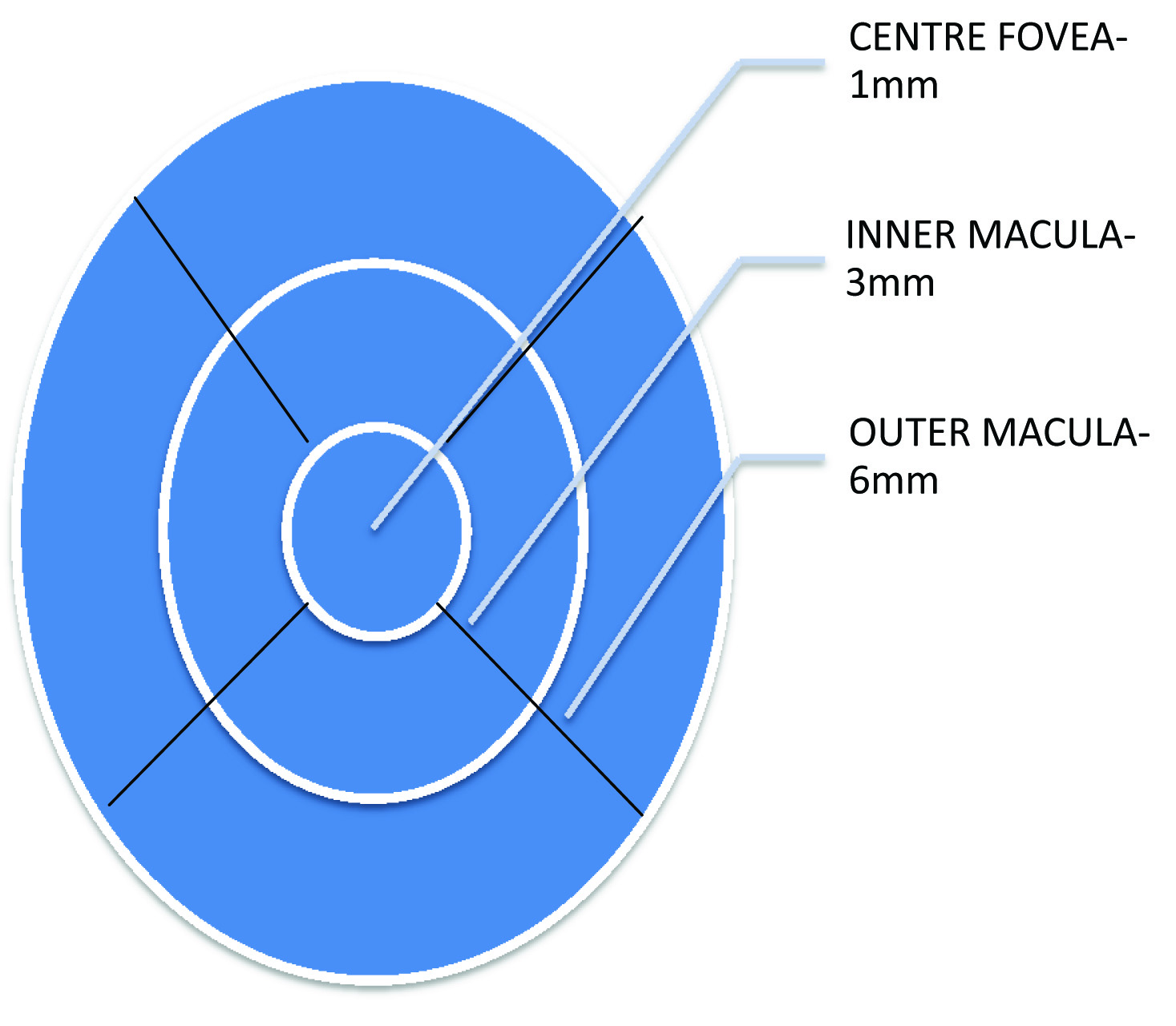 Comparision of various regions of macula with degree of myopia