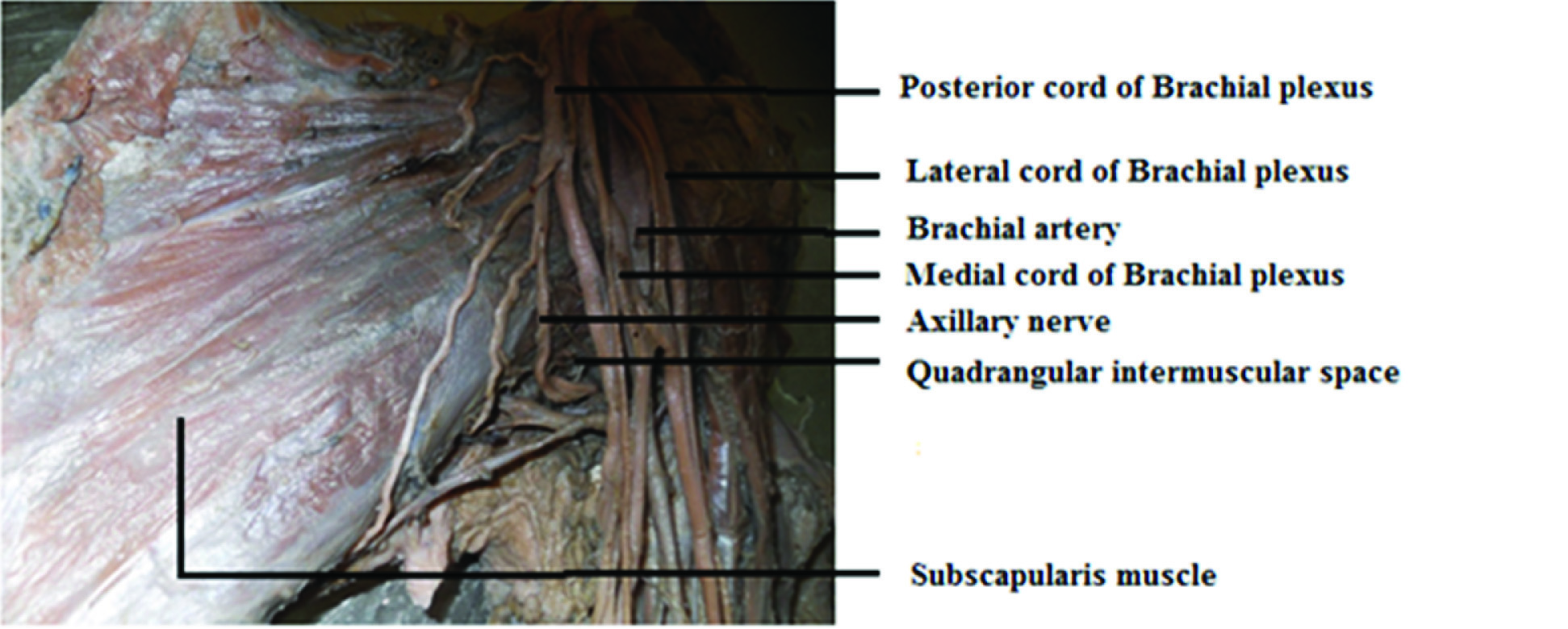 Axillary Nerve Cadaver
