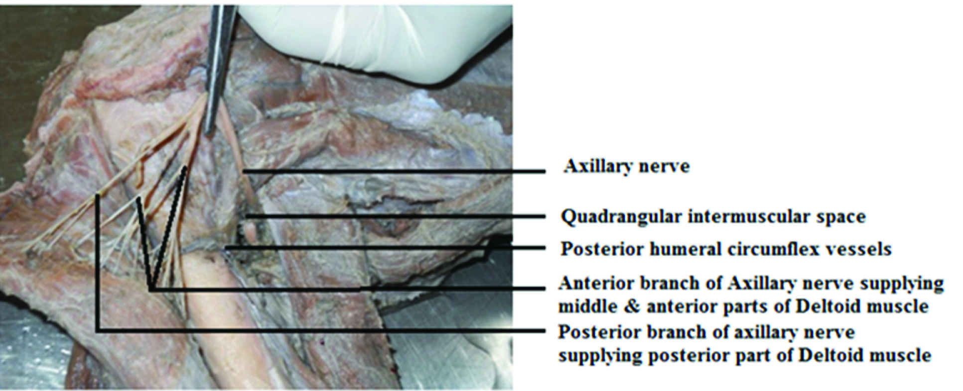 Axillary Nerve Cadaver