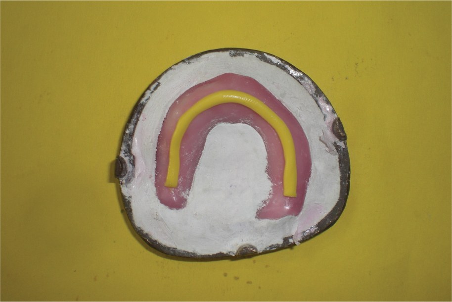 Space created for removal of putty