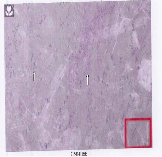 [Table/Fig-4]: