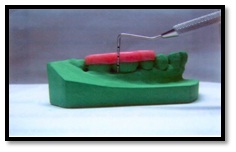 Stent with Pcp Unc-15 probe in place.