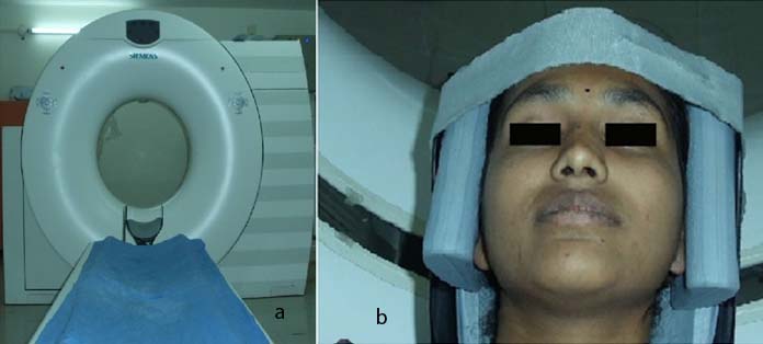 (a) Sagittal section of TMJ; (b) Coronal section of TMJ.