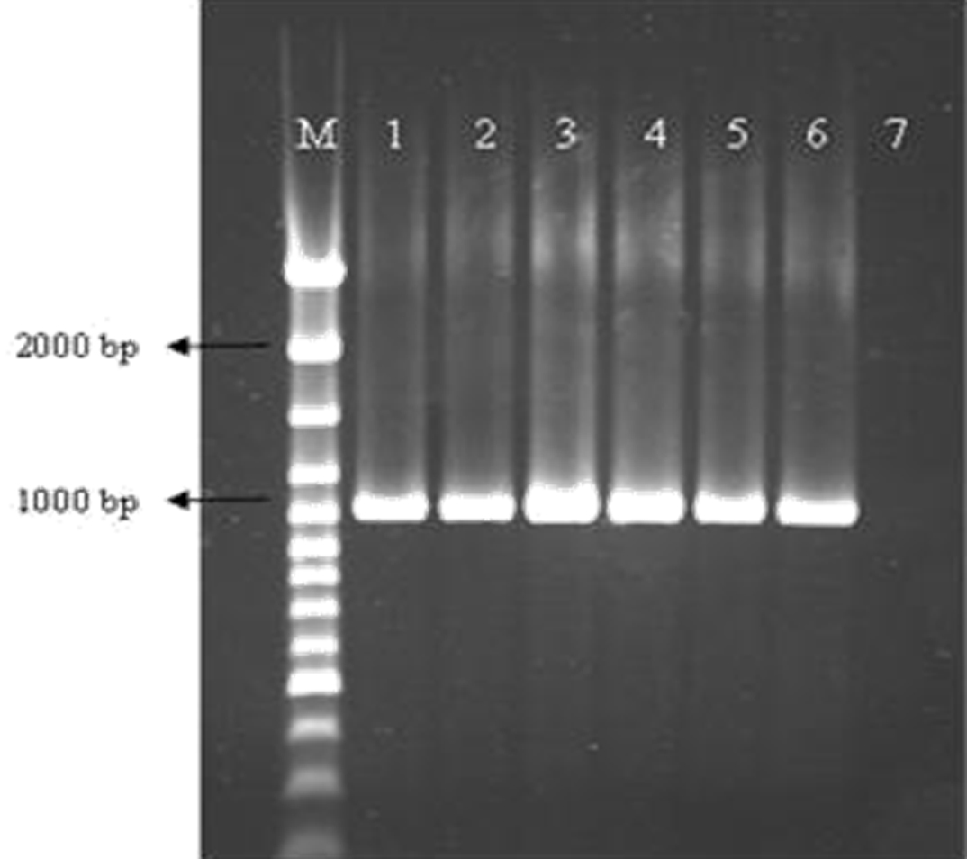 Turanose Fermentation in VRE and VSE isolates