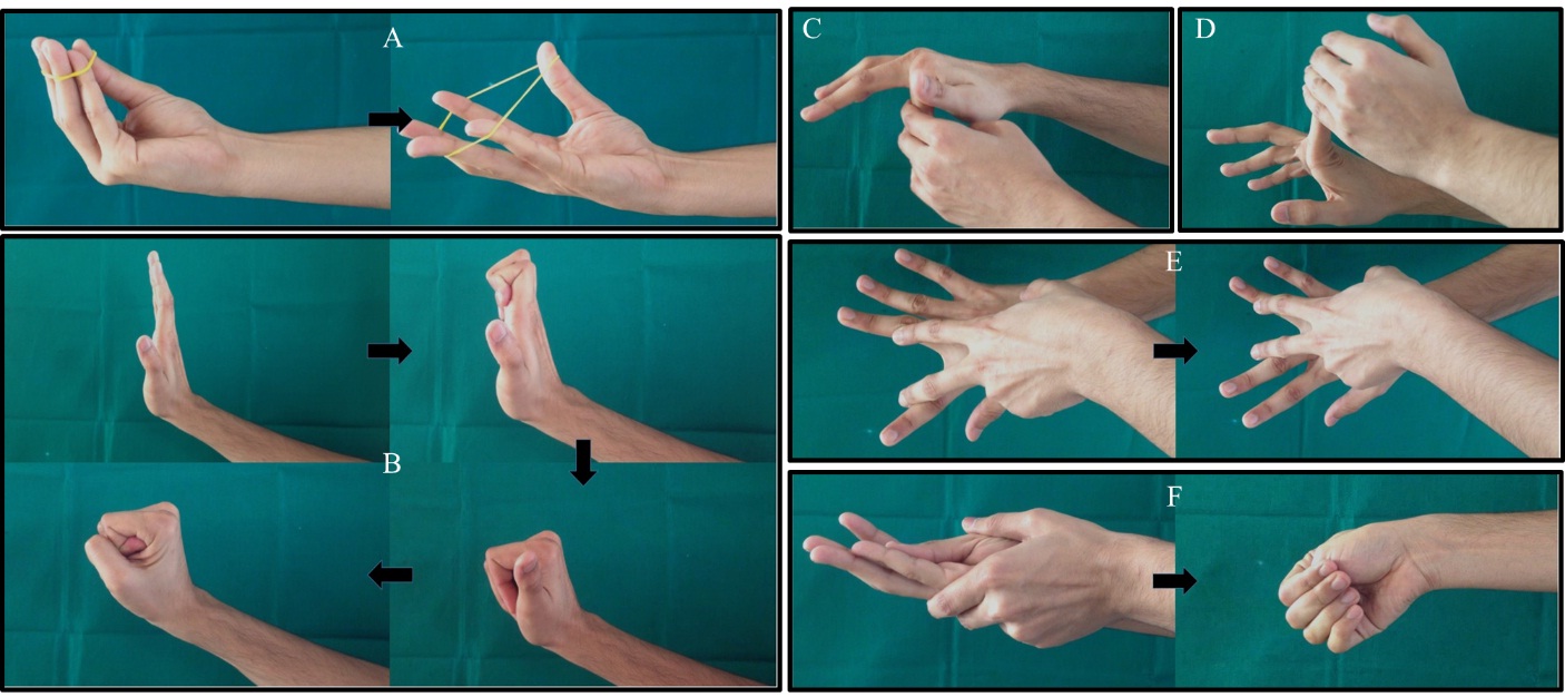 Subjects of group A repeated all of these stretches five times. PS was ...